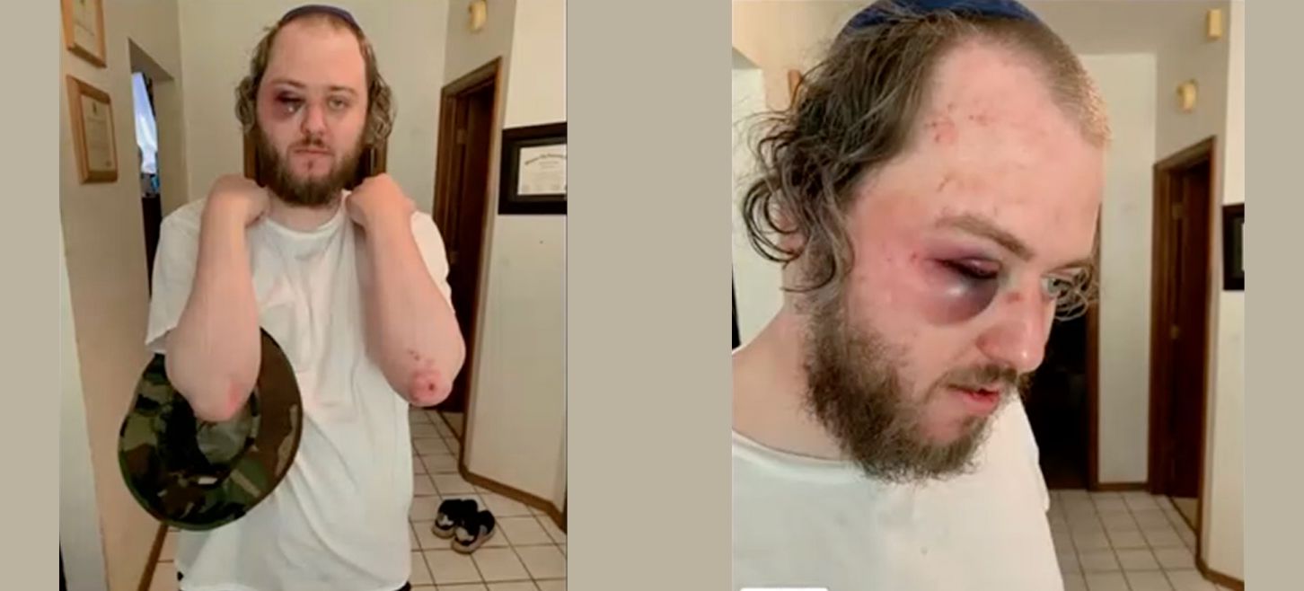 Campus Corner attack: Norman PD investigate potential hate crime